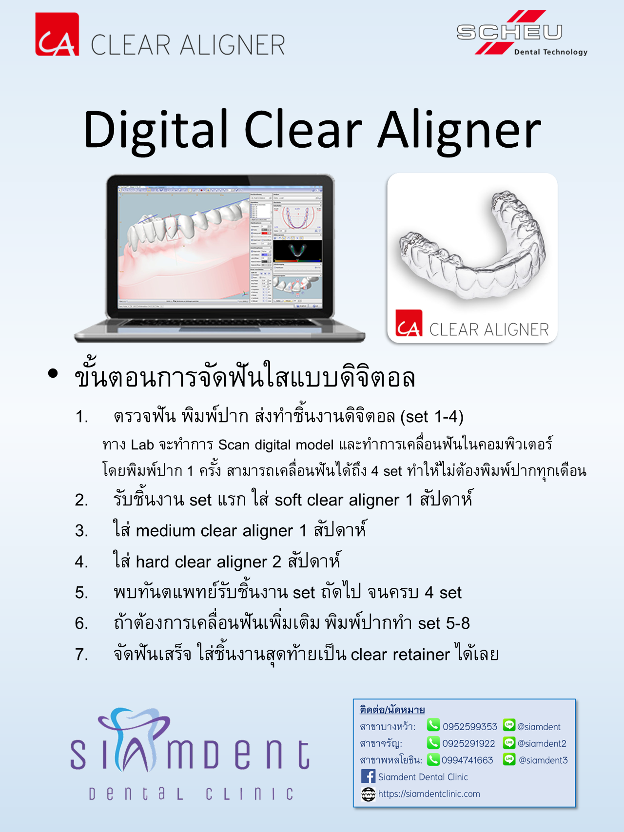 โปรโมชั่นจัดฟันใส digital clear aligner - Siamdent Dental Clinic
